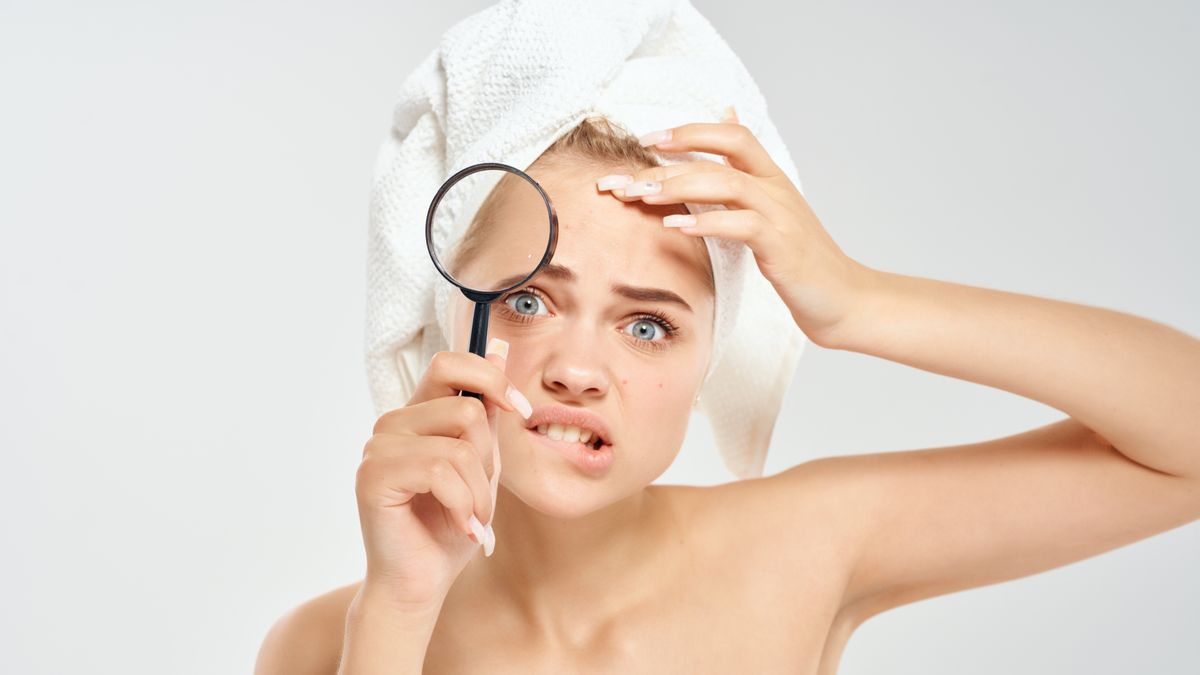 Mindig ugyanott nő pattanásod? Szervi problémákról árulkodhat ez a ...