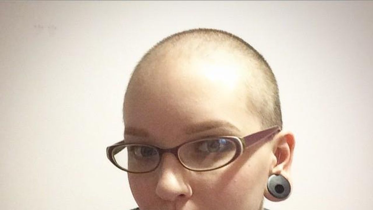 A 30 éves Allyson Lynch modellkarriert futott be, miután mellrákkal ...