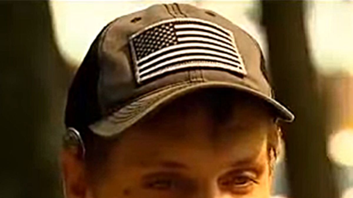 Nathan Hrdlicka a comb nélküli férfi, aki megtanult járni: fotó! - Life