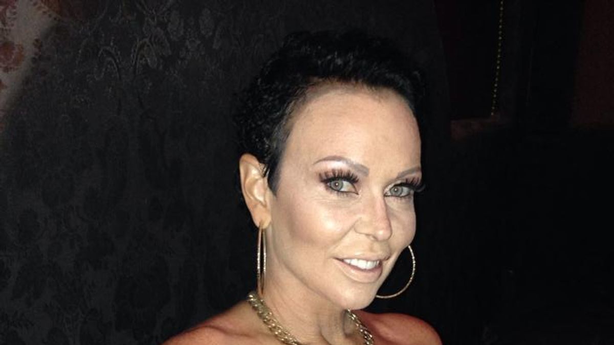 A nő, akinek tönkretette az életét egy plasztikai műtét - Life