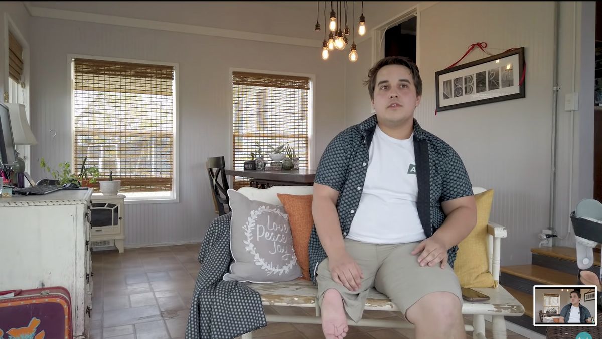 Christopher Hebert a férfi, akinek a térdéből nőtt ki a lábfeje - Life