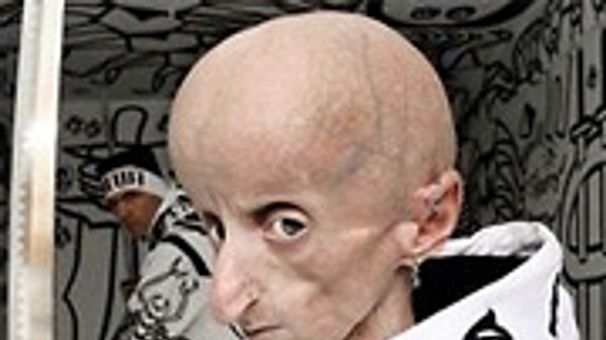 Elhunyt Leon Botha, a híres progeriás DJ - Life